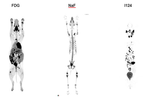Positron Emission Tomography (PET/CT)